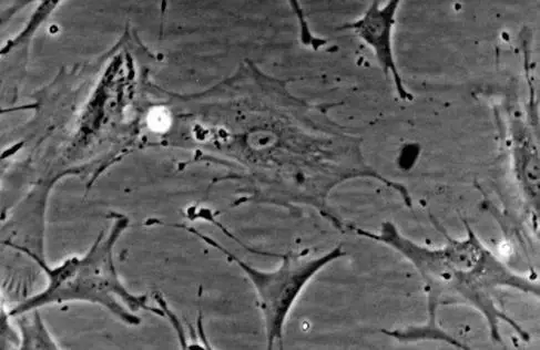 Brighton professor brings expertise to new government report on ageing ...